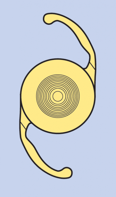 Medlens Optics: intraocular lenses from Alcon