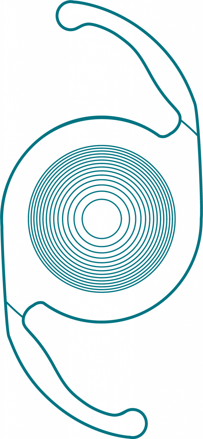 Medlens Optics: intraocular lenses from Alcon